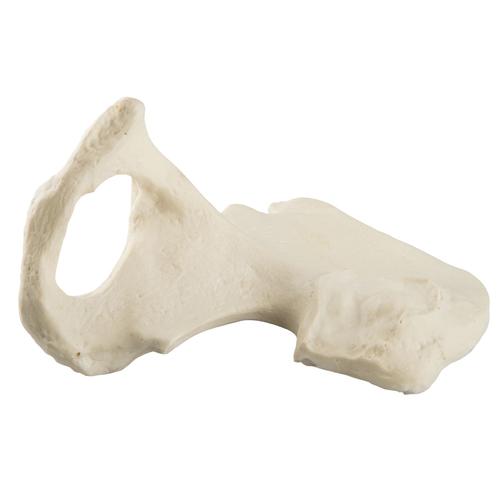 ORTHObones Standard Hemi Pelvis,m.,right – Medute