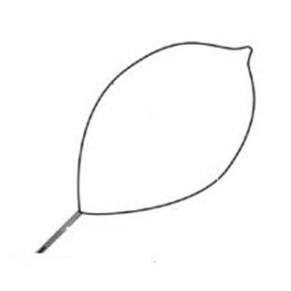 Conmed Corporation Snare Polypectomy Firm Loop Wire Oval 32mm Large 10 ...