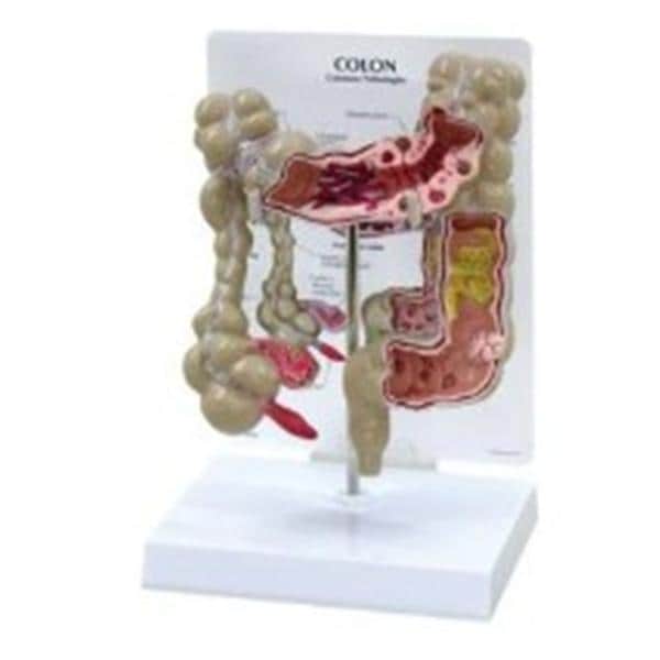 Wards Natural Science Model Colon GPI Anatomicals Each - 470002-666 ...