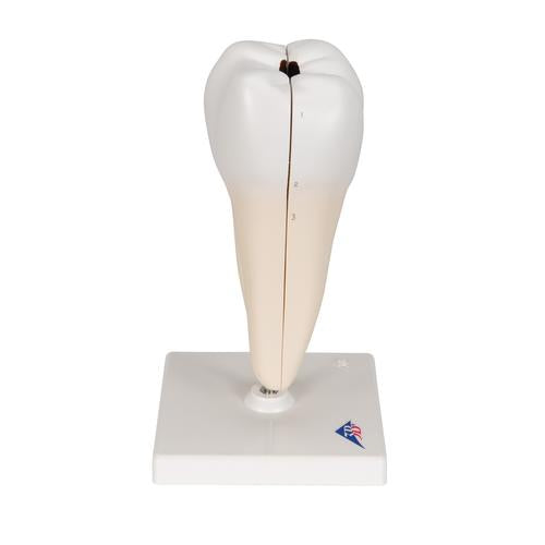 Lower Twin-Root Molar with Cavities Human Tooth Model, 2 part - 3B Sma ...