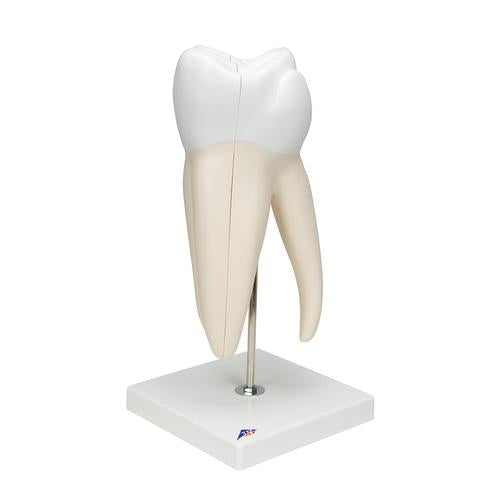 Giant Molar with Dental Cavities Human Tooth Model, 15 times Life-Size ...