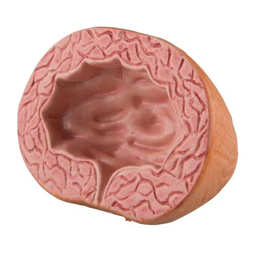 Spare front bladder half – Medute